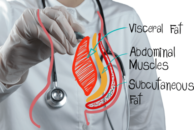 Body Fat Distribution: Subcutaneous vs. Visceral Fat | Fort Collins ...